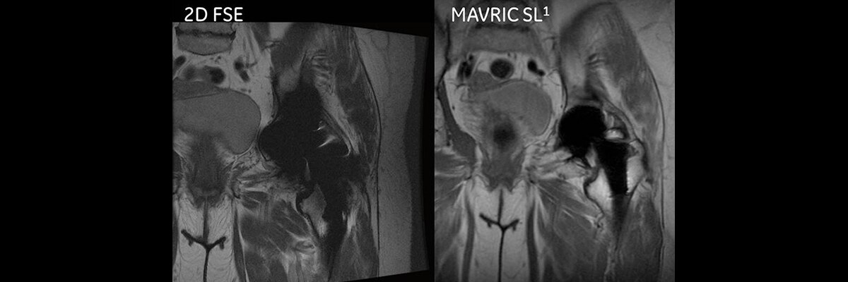 MAVRIC SL | GE Healthcare (Spain)