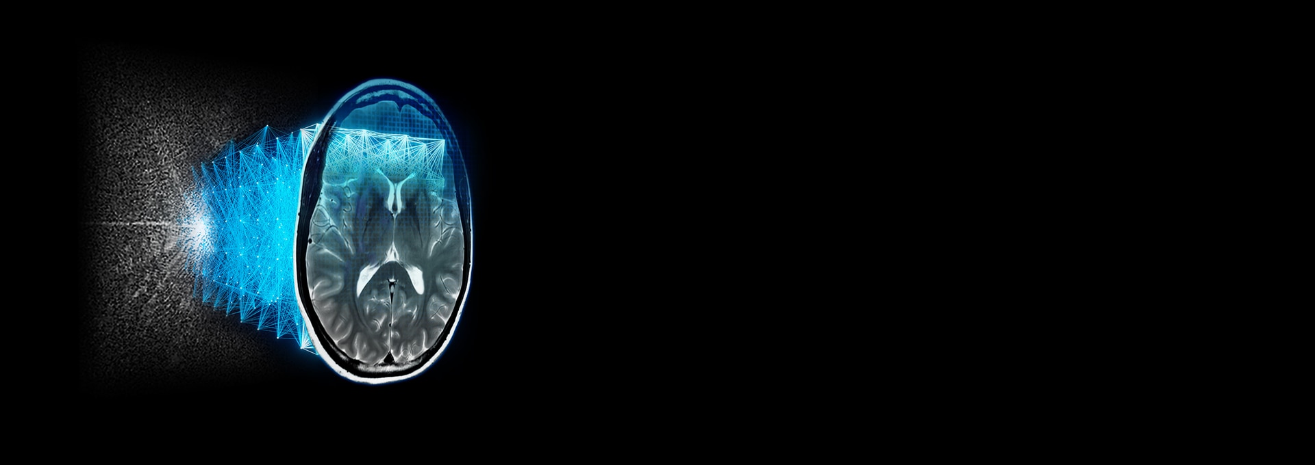 SIGNA™ Premier AIR™ Edition | GE Healthcare (Spain)