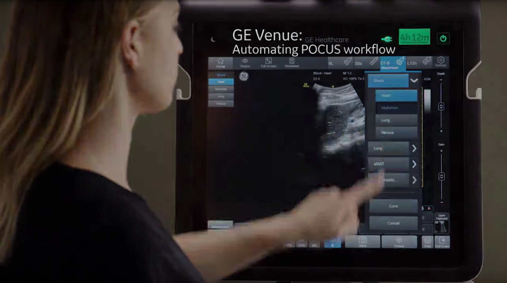Ecógrafo móvil Venue de GE| GE Healthcare (Spain)